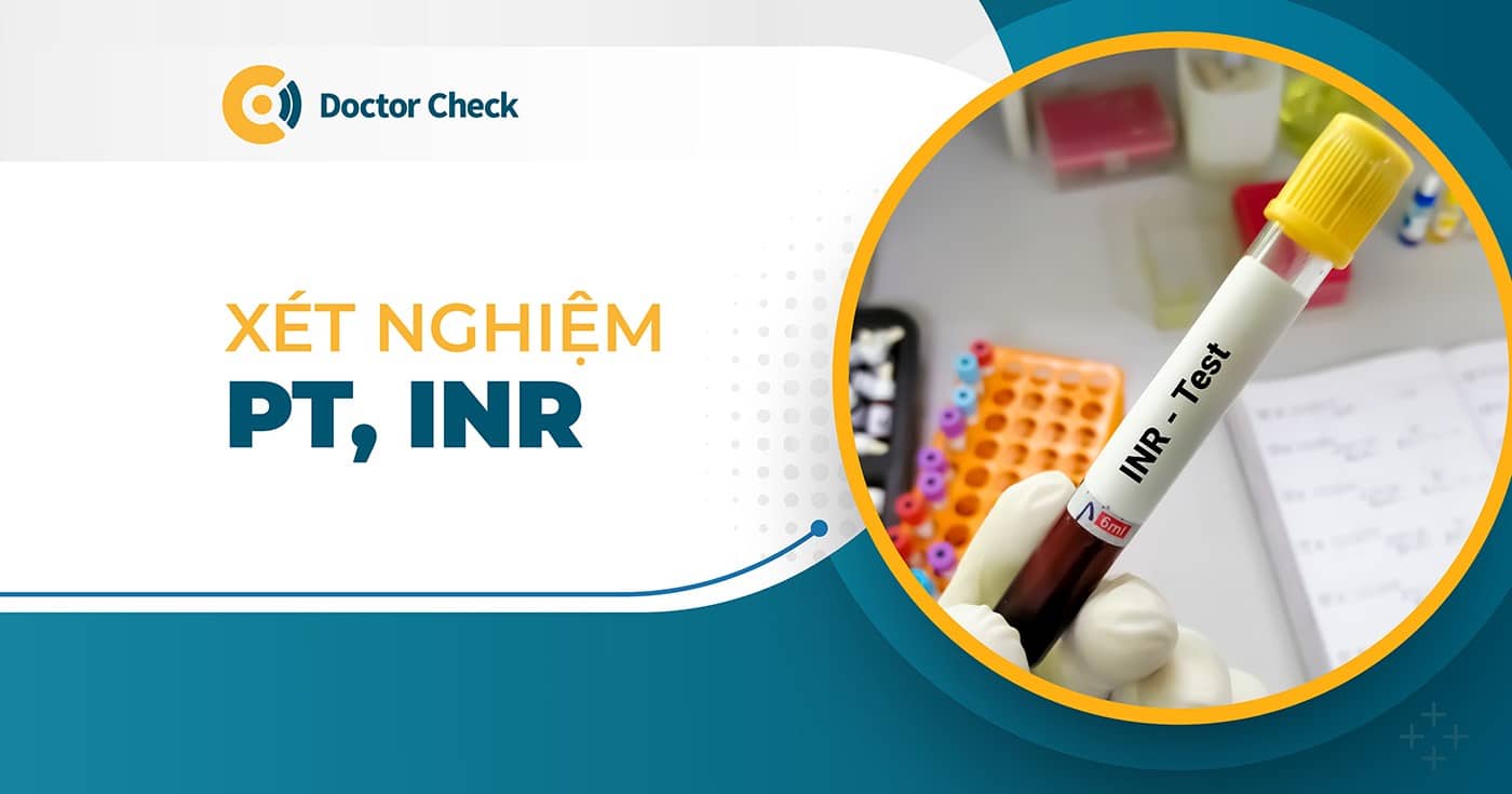 Prothrombin là gì? Chỉ số PT, INR bất thường có nguy hiểm không?
