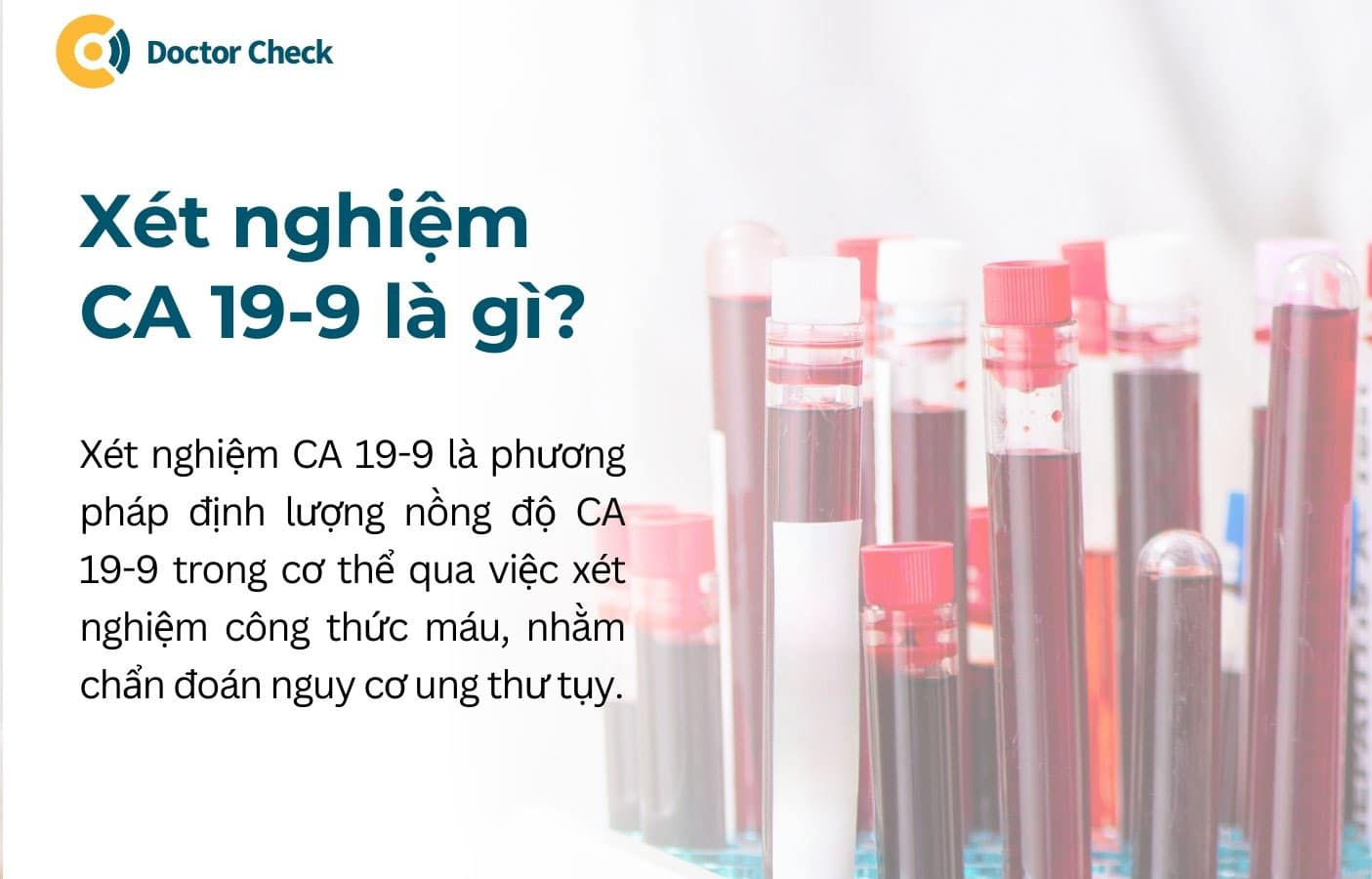 CA 19-9 là gì? Chỉ số CA 19-9 tăng cao có mắc ung thư tuỵ?