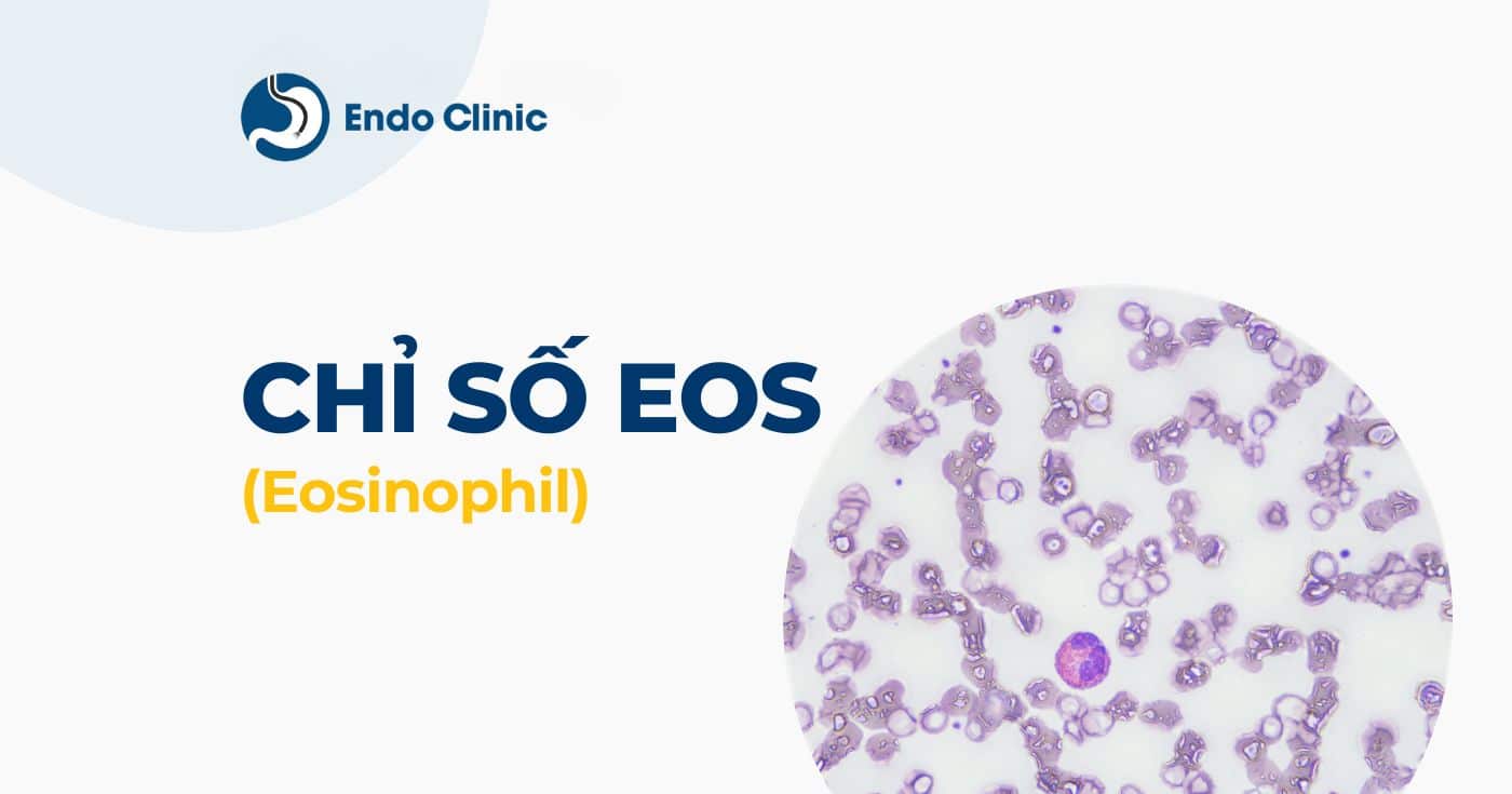 EOS là gì? Chỉ số EOS trong máu tăng cao cảnh báo bệnh gì? - Endo Clinic