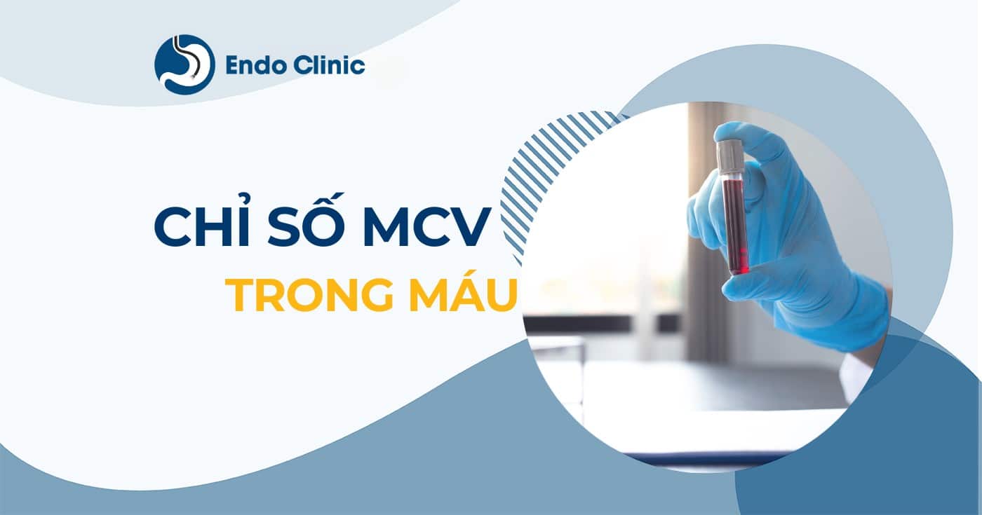 Chỉ số MCV là gì? Chỉ số MCV thấp có sao không? - Endo Clinic