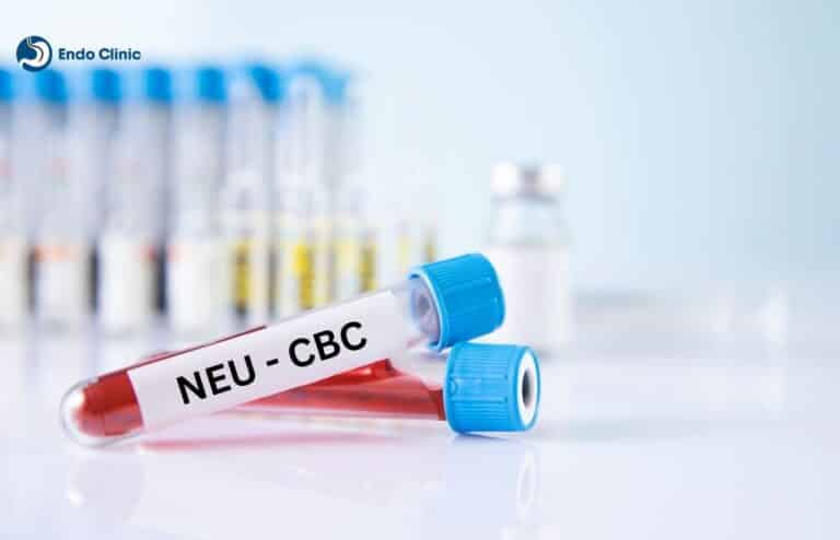 NEU là gì? NEUT trong xét nghiệm máu cao nguy hiểm như nào? - Endo Clinic