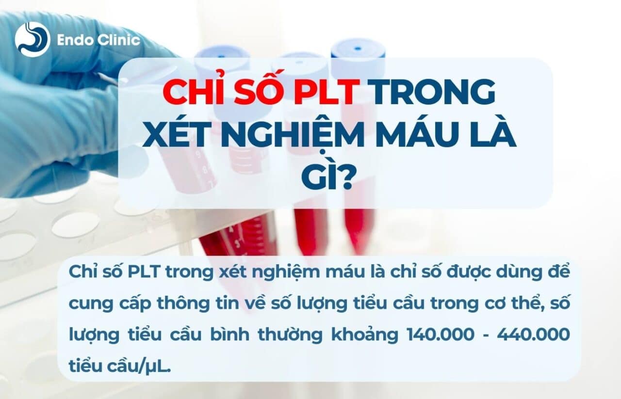 PLT là gì? Bệnh lý nào làm chỉ số PLT bất thường trong máu?