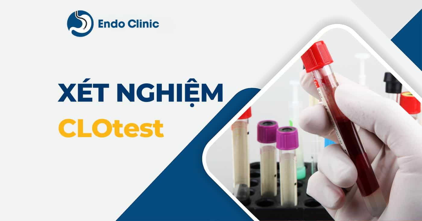 CLOtest là gì? CLOtest dương tính có nguy hiểm không? - Endo Clinic